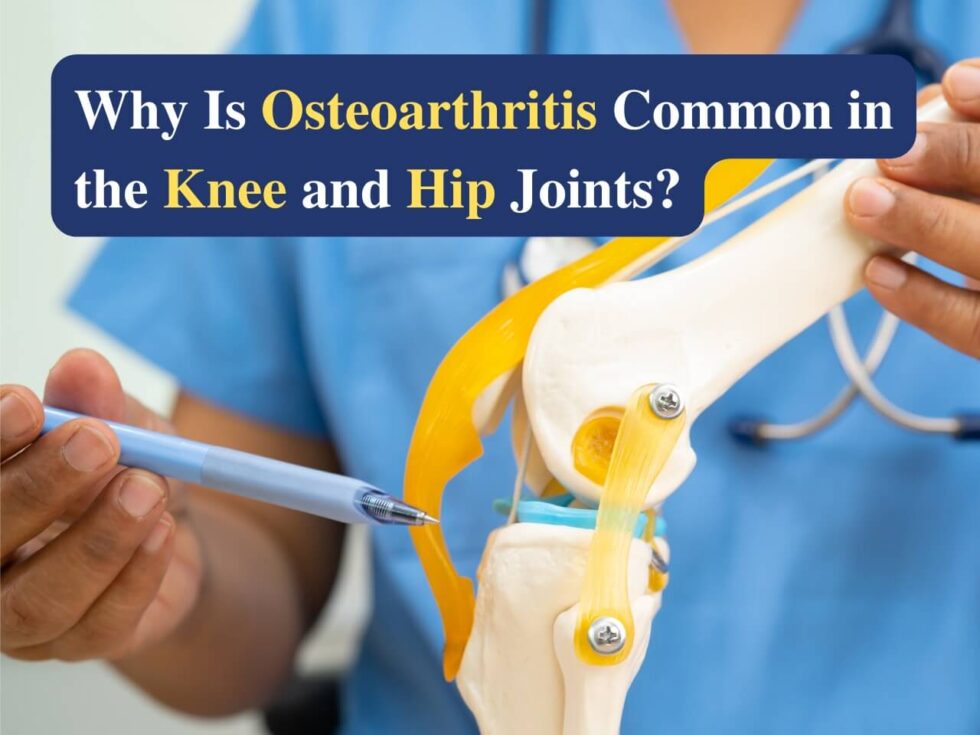 Why is Osteoarthritis Common in the Knee and Hip Joints?